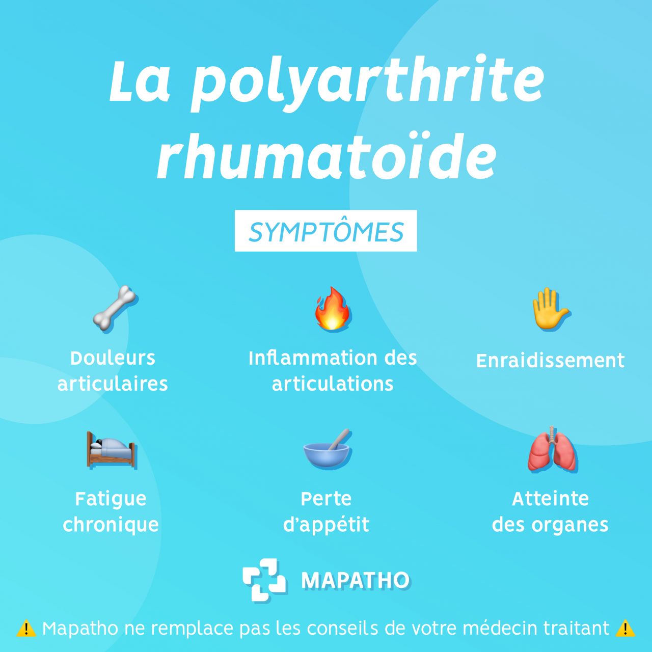 Polyarthrite Rhumatoïde Symptômes Yeux – EQIUWY